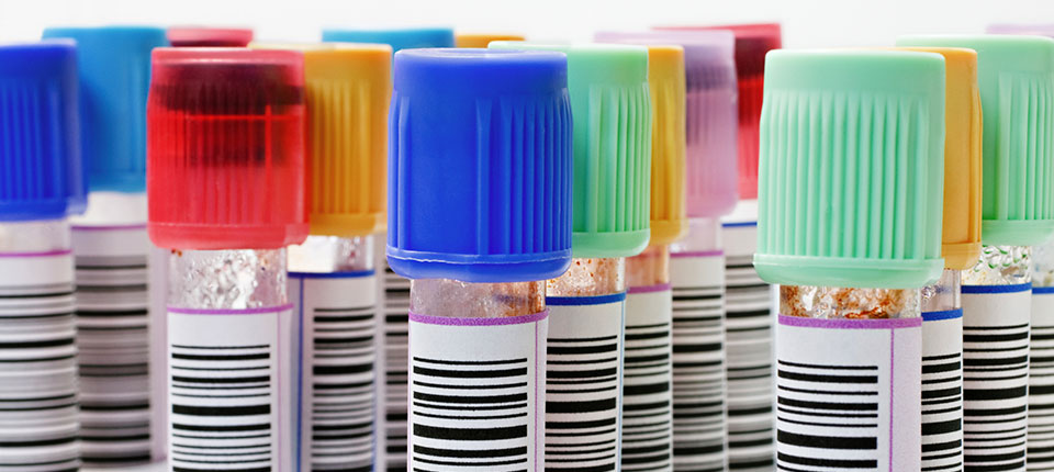 Alinity ci-series | Abbott Newsroom